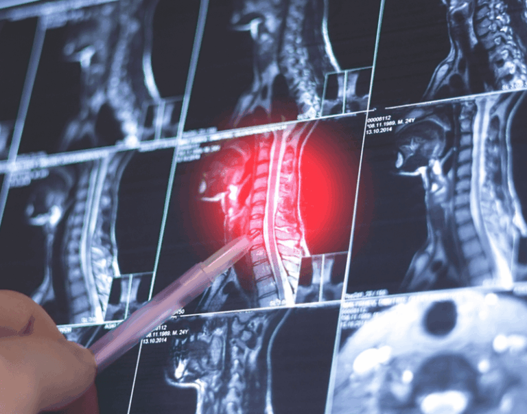 How Is Nerve Pain Diagnosed and Treated in Singapore?